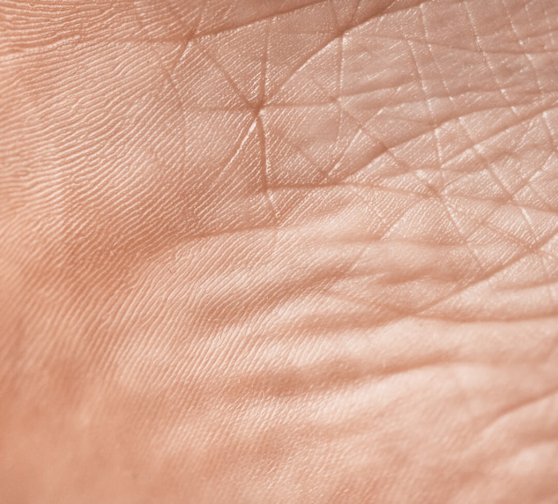 Exploring the Great Unknown of the Skin Microbiome | Benaroya Research ...