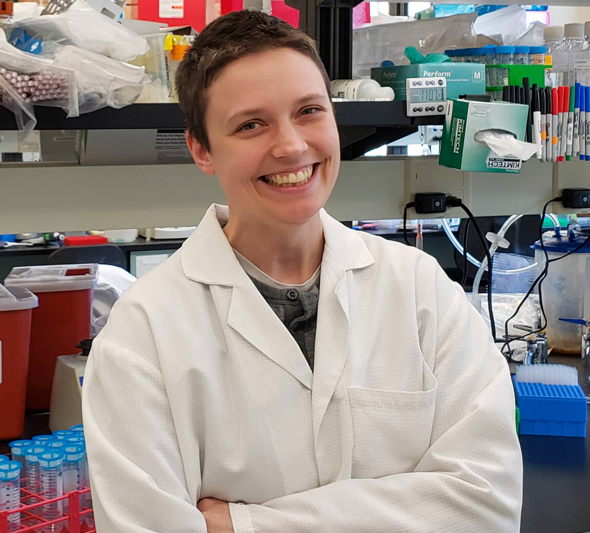 Unmasking Lupus: The Great Masquerader | Benaroya Research Institute