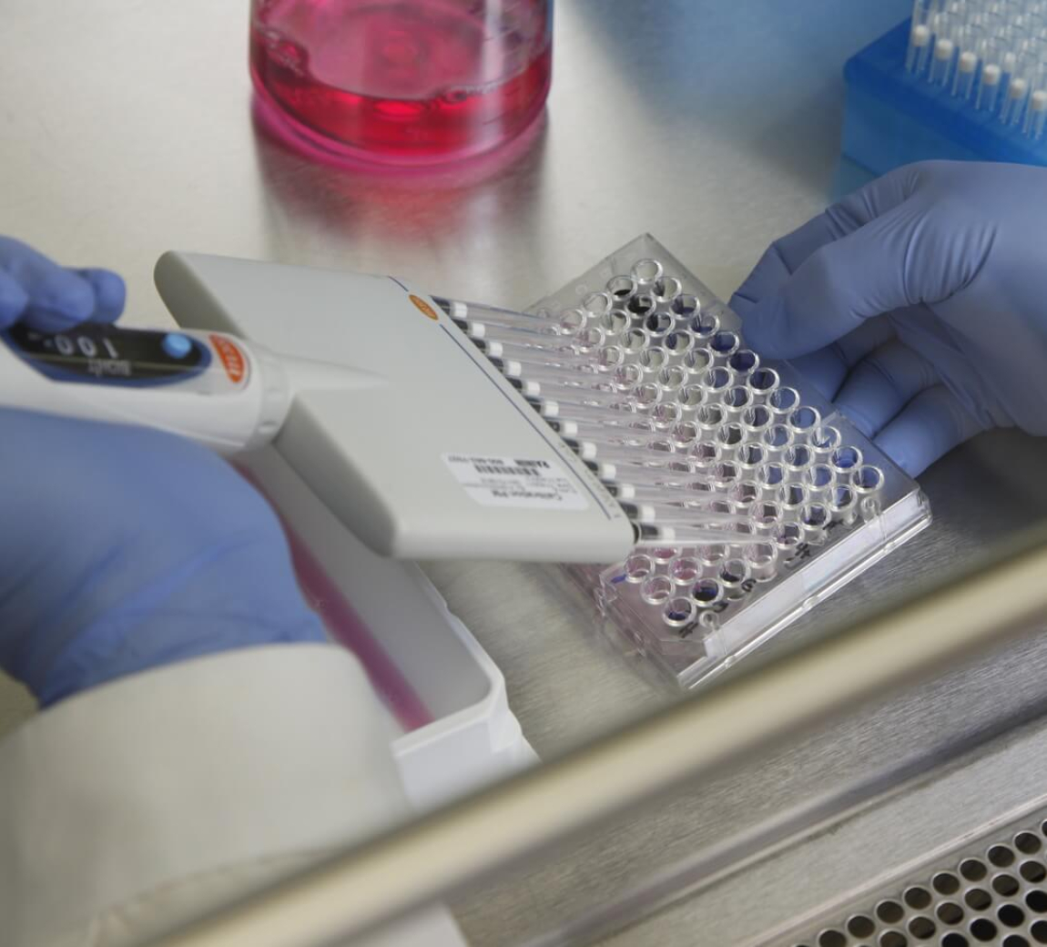 Turning the Tide in Lupus Research | Benaroya Research Institute