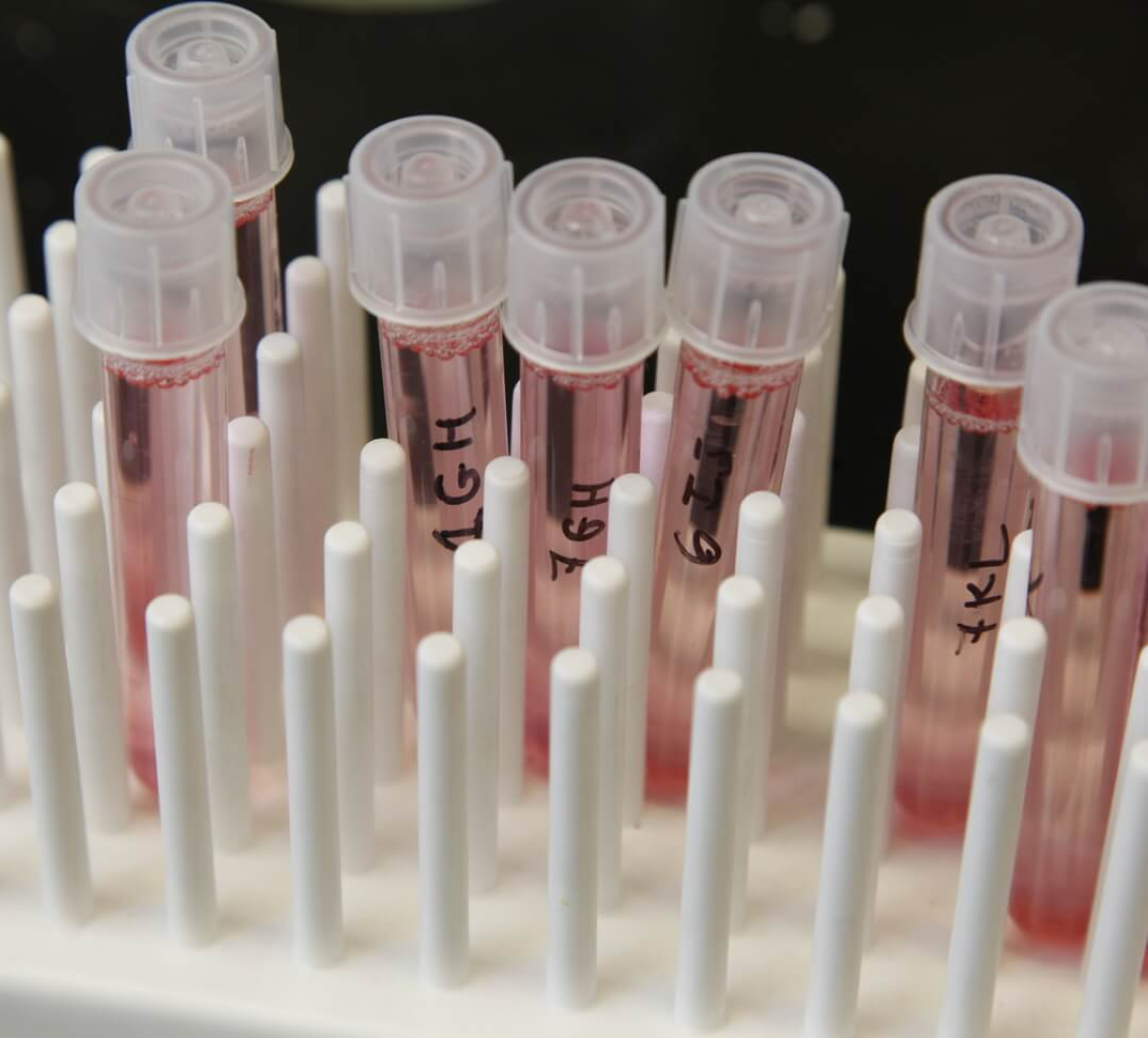 How BRI is Fighting COVID-19 | Benaroya Research Institute