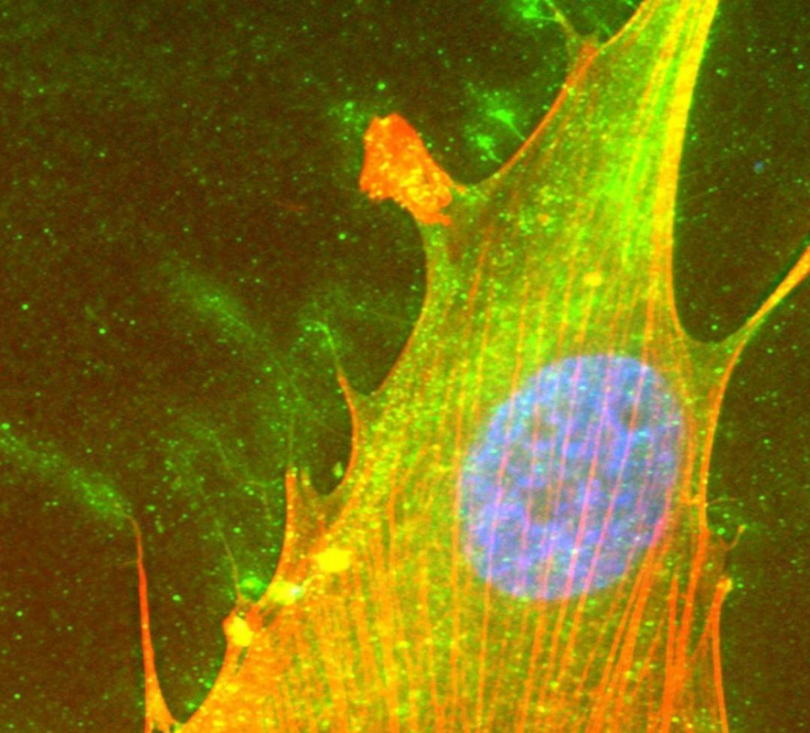 Pursuing a Revolution in IBD Treatment | Benaroya Research Institute
