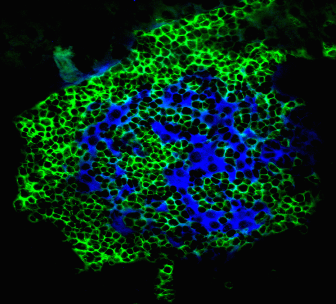 TSLP: From Intriguing Protein to Groundbreaking Therapy | Benaroya ...