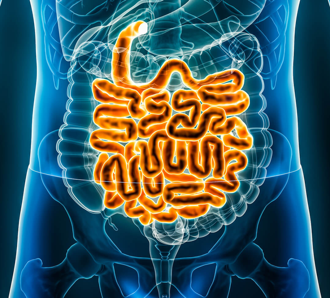 Ready for This Moment: Exploring Prevention of Ulcerative Colitis ...