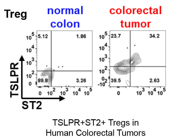 The Role of TSLPR+St2+ Tregs in colorectal cancer | Benaroya Research ...