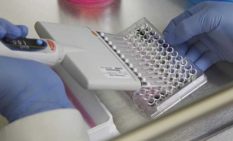 James Lab | Benaroya Research Institute