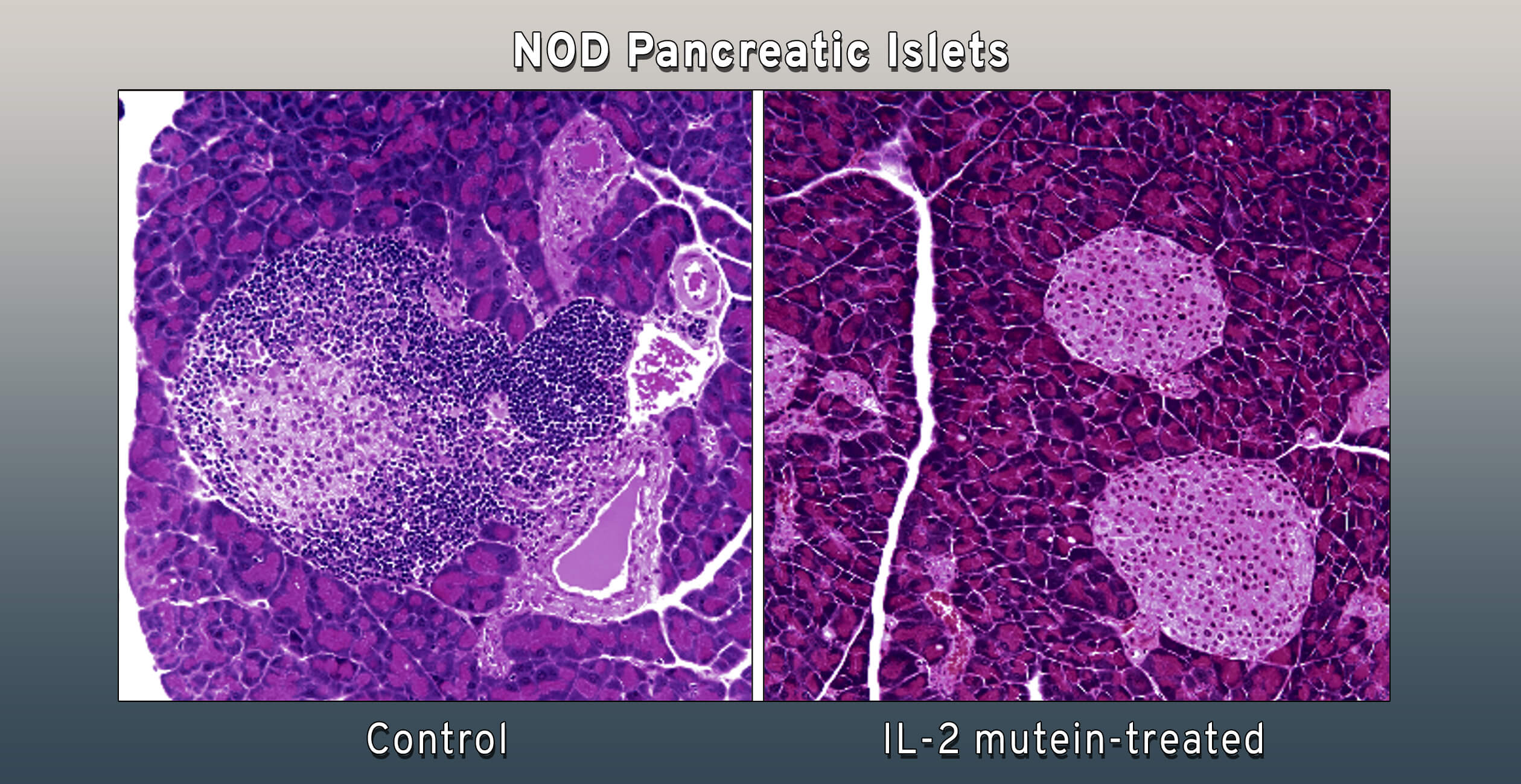Restoring immune tolerance via regulatory T cell-targeted IL-2 mutein ...