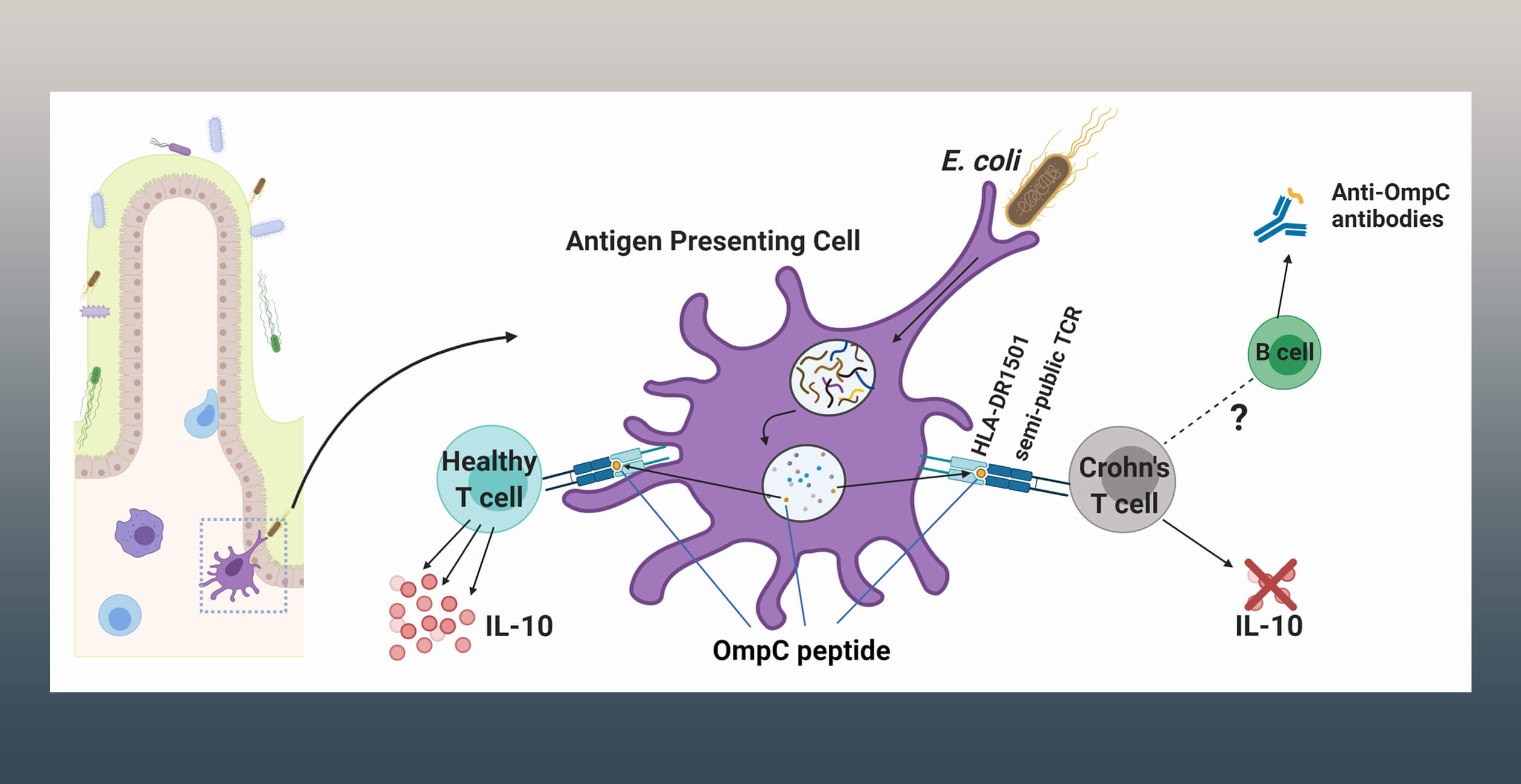 T Cells in Inflammatory Bowel Disease | Benaroya Research Institute