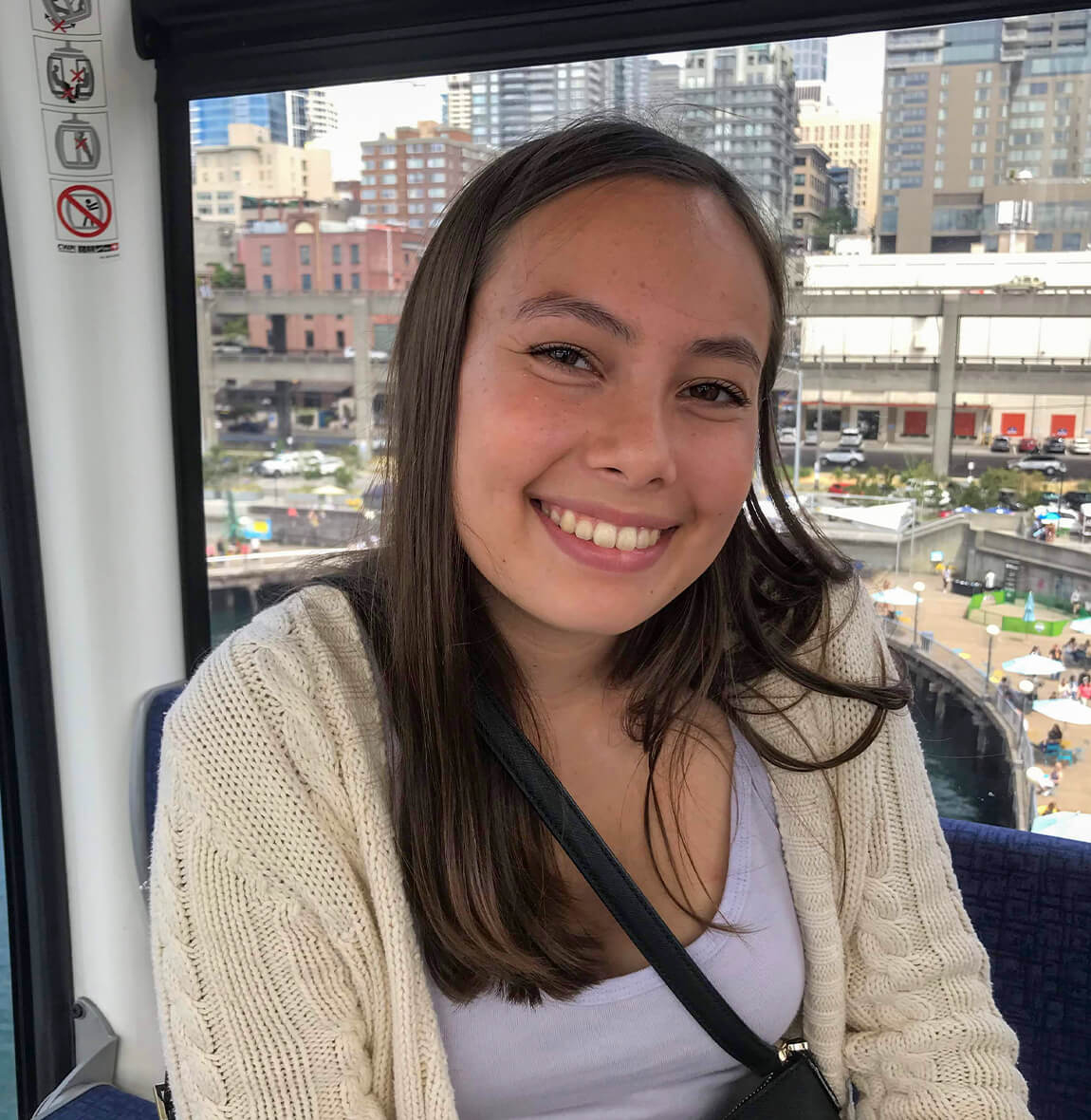 Anna Yoshida | Benaroya Research Institute